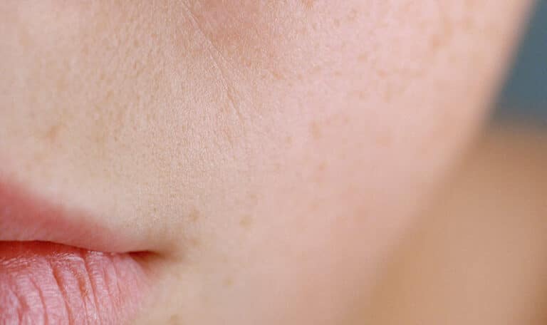 10 Low Iron (Anemia) Symptoms & Early Signs - Don't Ignore - OptingHealth