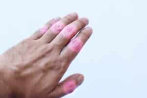 What Causes Hand Cramps? 11 Possible Causes You Should Know - OptingHealth