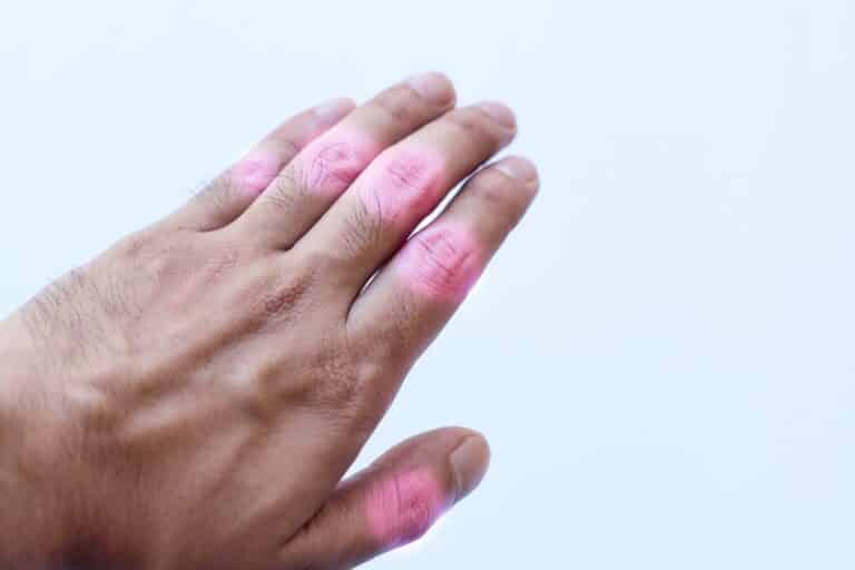 What Causes Hand Cramps? 11 Possible Causes You Should Know - OptingHealth