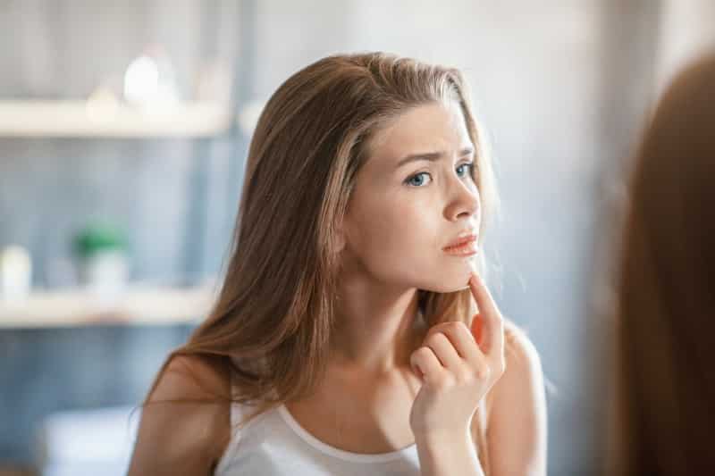 What Are The Causes Of Chin Acne? 12 Common Triggers - OptingHealth What Are The Causes Of Chin Acne? 12 Common Triggers - OptingHealth