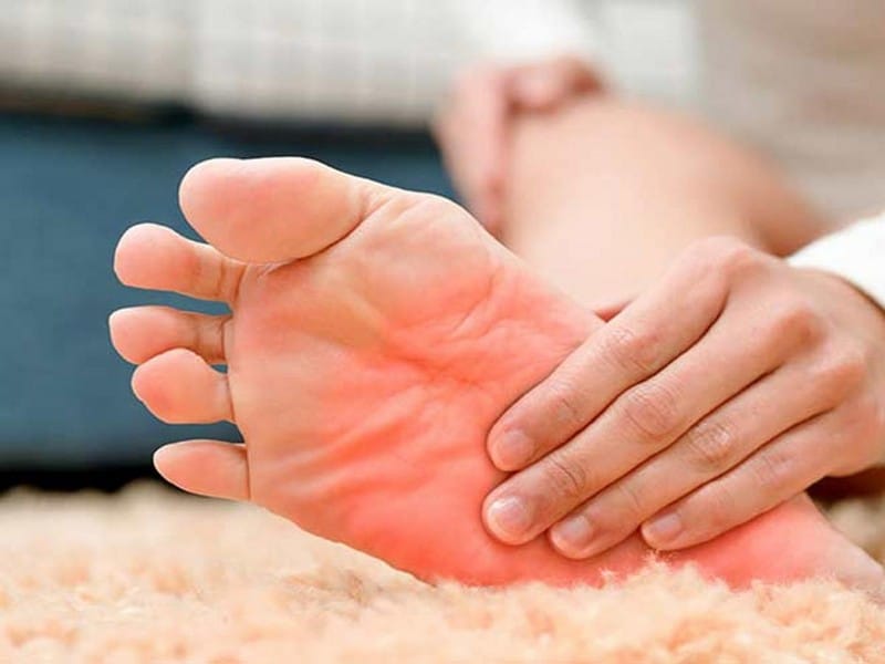 12 Home Remedies For Burning Feet: How To Get Rid Of It - OptingHealth