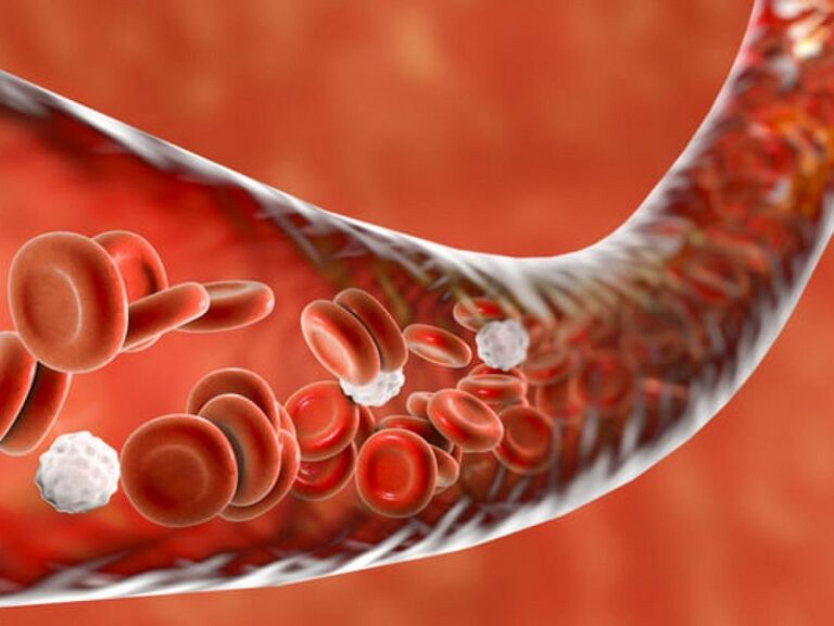 What Are The Triggers Of Low Anion Gap? 13 Common Causes - OptingHealth