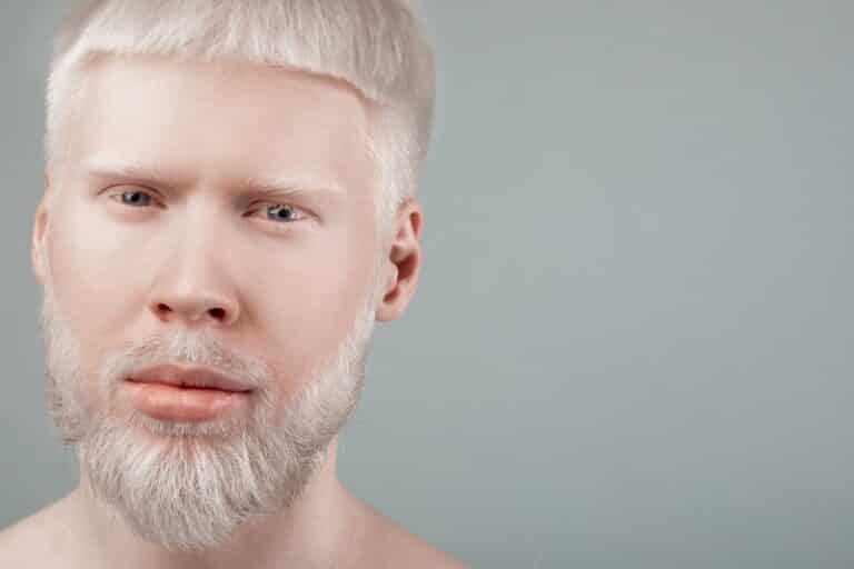 12 Signs And Symptoms Of Folic Acid Deficiency To Know - OptingHealth