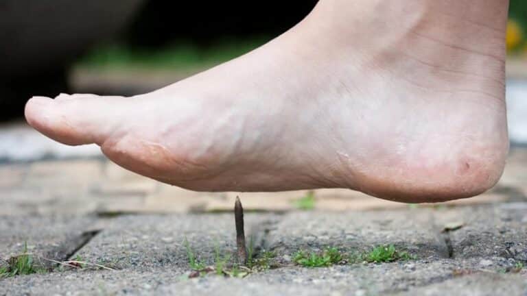 What Causes Necrotizing Fasciitis? 12 Causes To Consider - OptingHealth