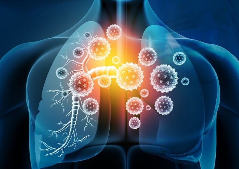 15 Symptoms Of Lung Infection (Early Warning Signs) - OptingHealth